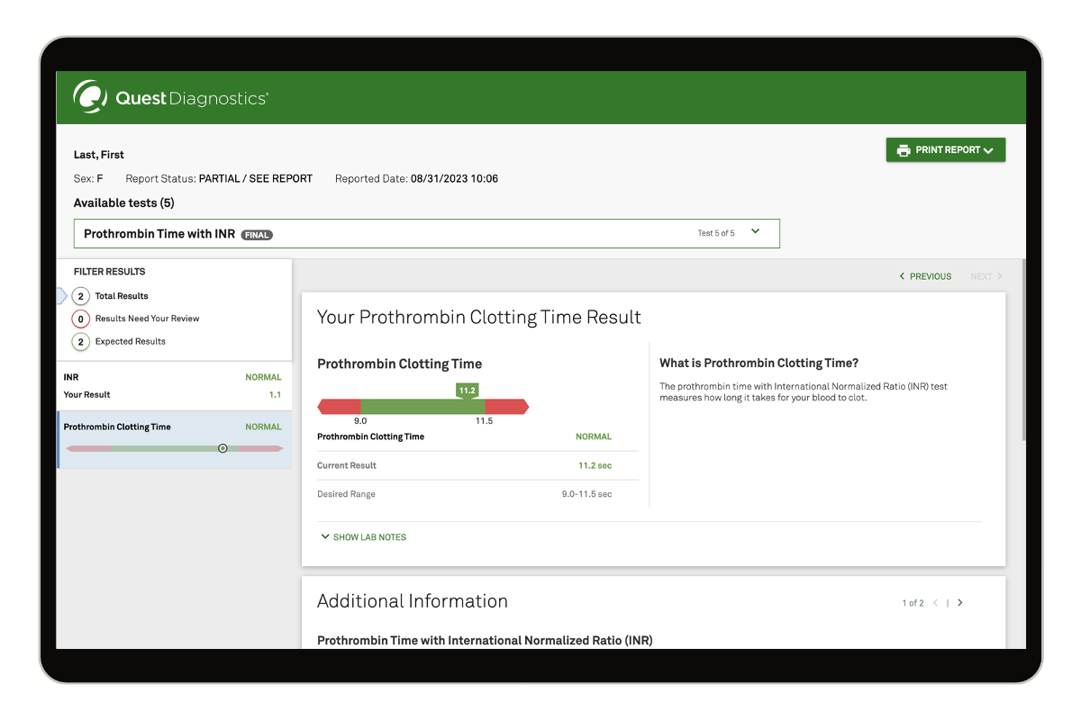 Prothrombin Time with INR