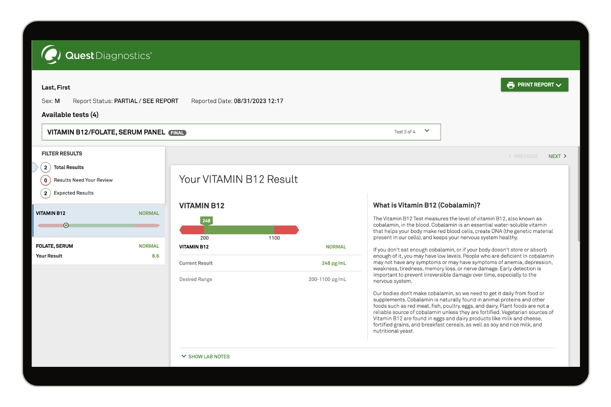 Vitamin B12 & Folate Test